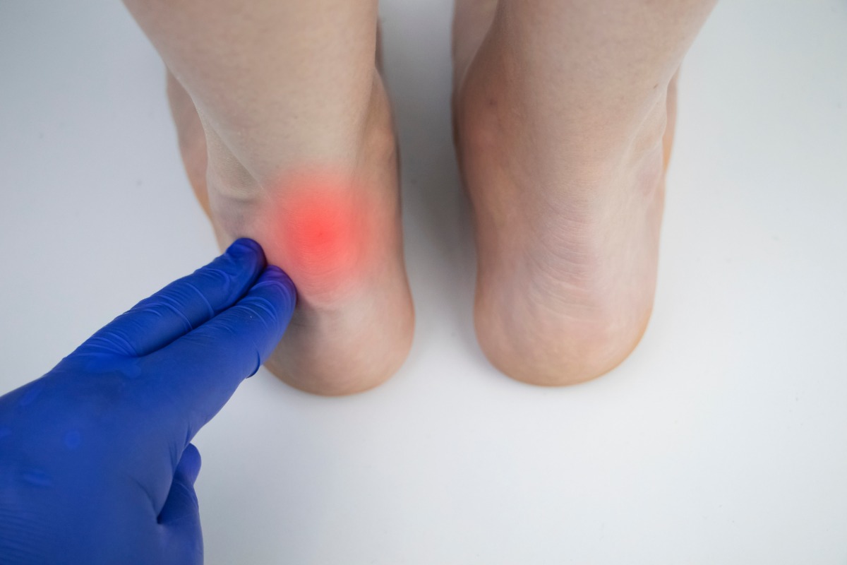 Achilles Heel Pain: Causes, Treatment and FAQs