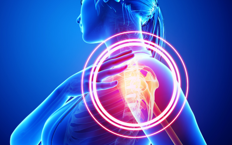 Shoulder Impingement | Orthopedic Shoulder Treatment | OSMC