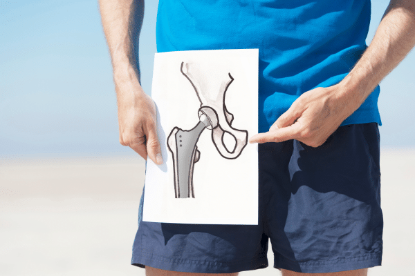 Anterior Lateral Hip Replacement Surgery at OSMC